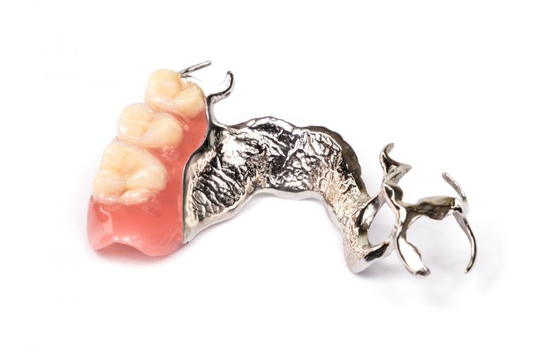 Zahnersatz - Neue Zähne - Ihr Dentallabor aus Osnabrück